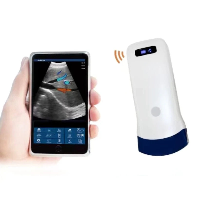 Wireless Ultrasound Probe WIFI Probe CProbe-5C Color Doppler 128E ...