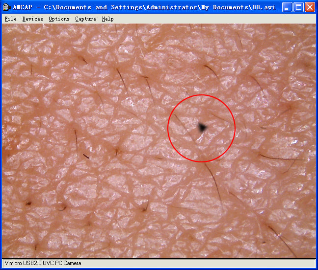 HD 5 million pixels facial skin analyzer detector Skin Scope Oily Acne