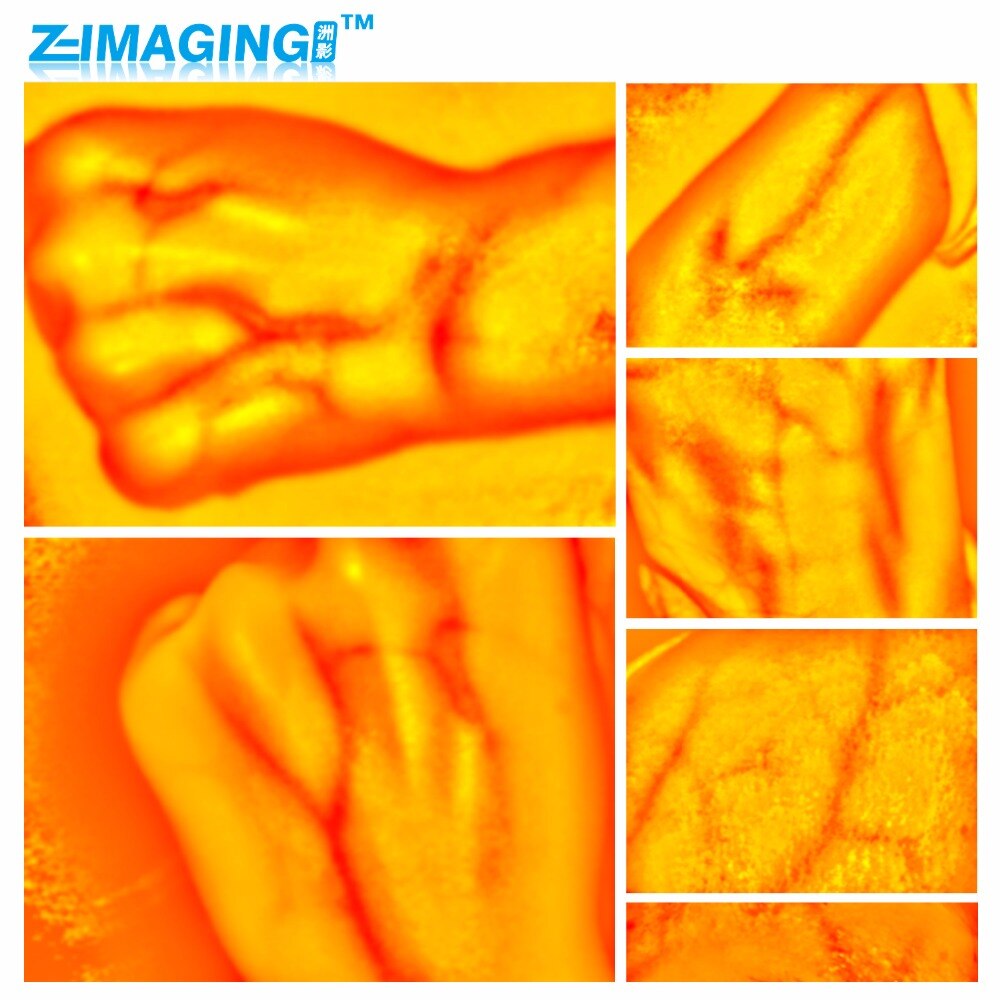 HD Vein Imaging Vein Viewer Vein Finder Vein Camera