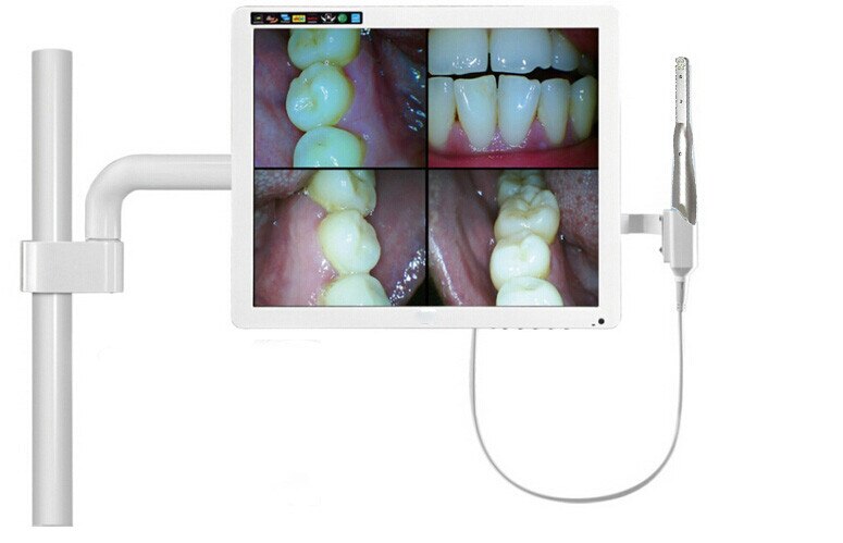 Dental Intraoral Camera USB 2.0 Dynamic 4 Mega Pixels 6-LED Dentist In