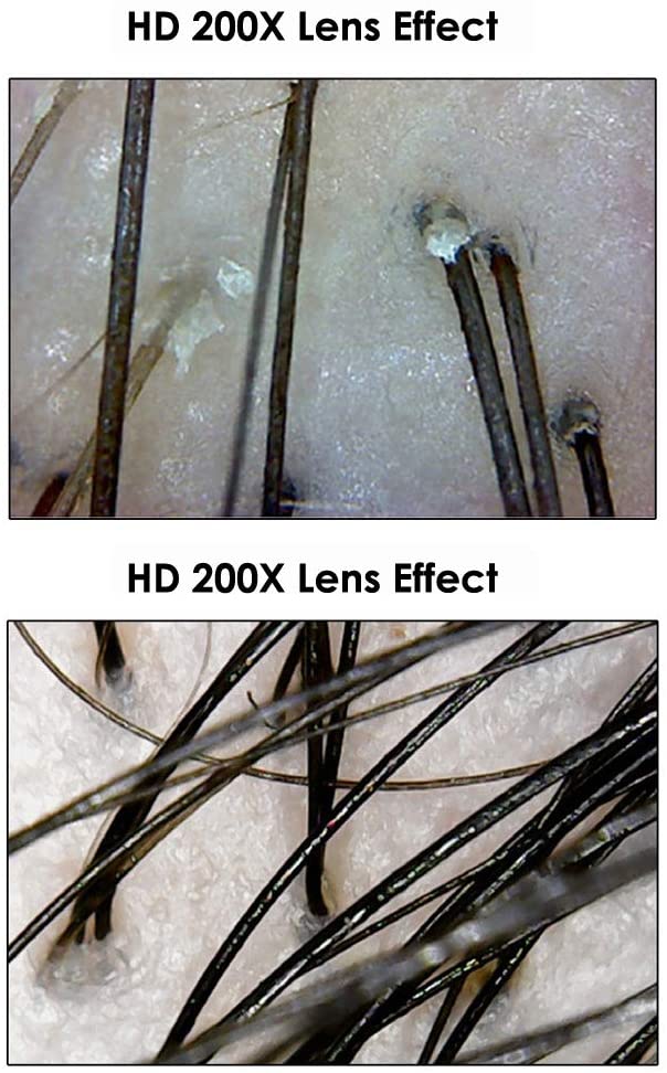 Facial Skin Analyzer Hair Analyser Machine Digital Dermoscopy Skin ...