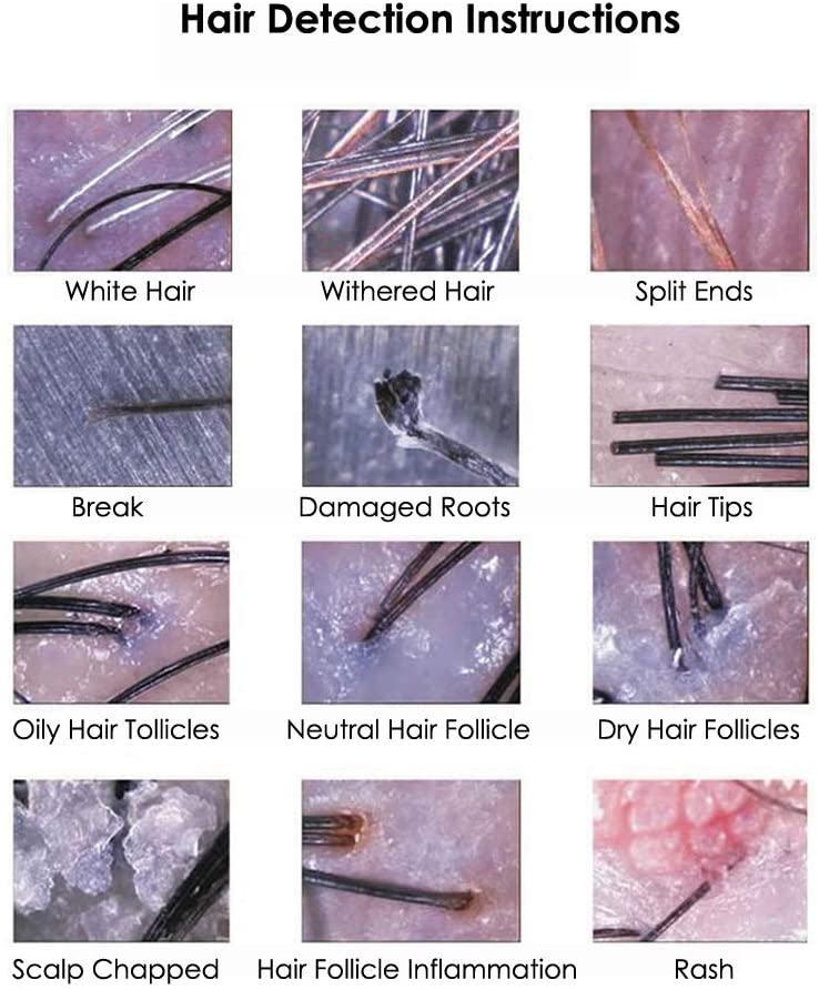 Facial Skin Analyzer Hair Analyser Machine Digital Dermoscopy Skin ...