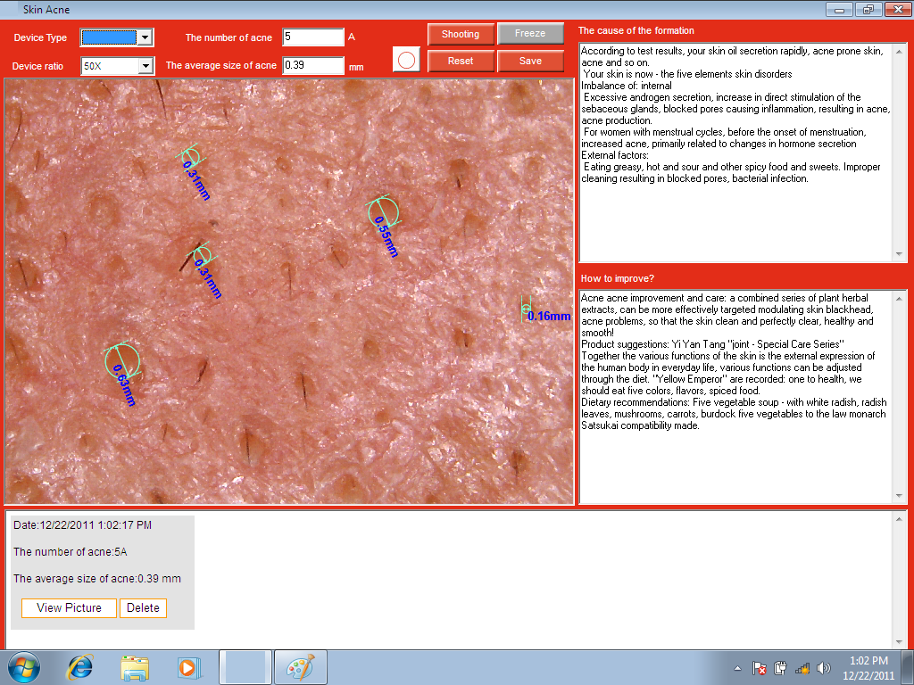 HD 5 million pixels facial skin analyzer detector Skin Scope Oily Acne